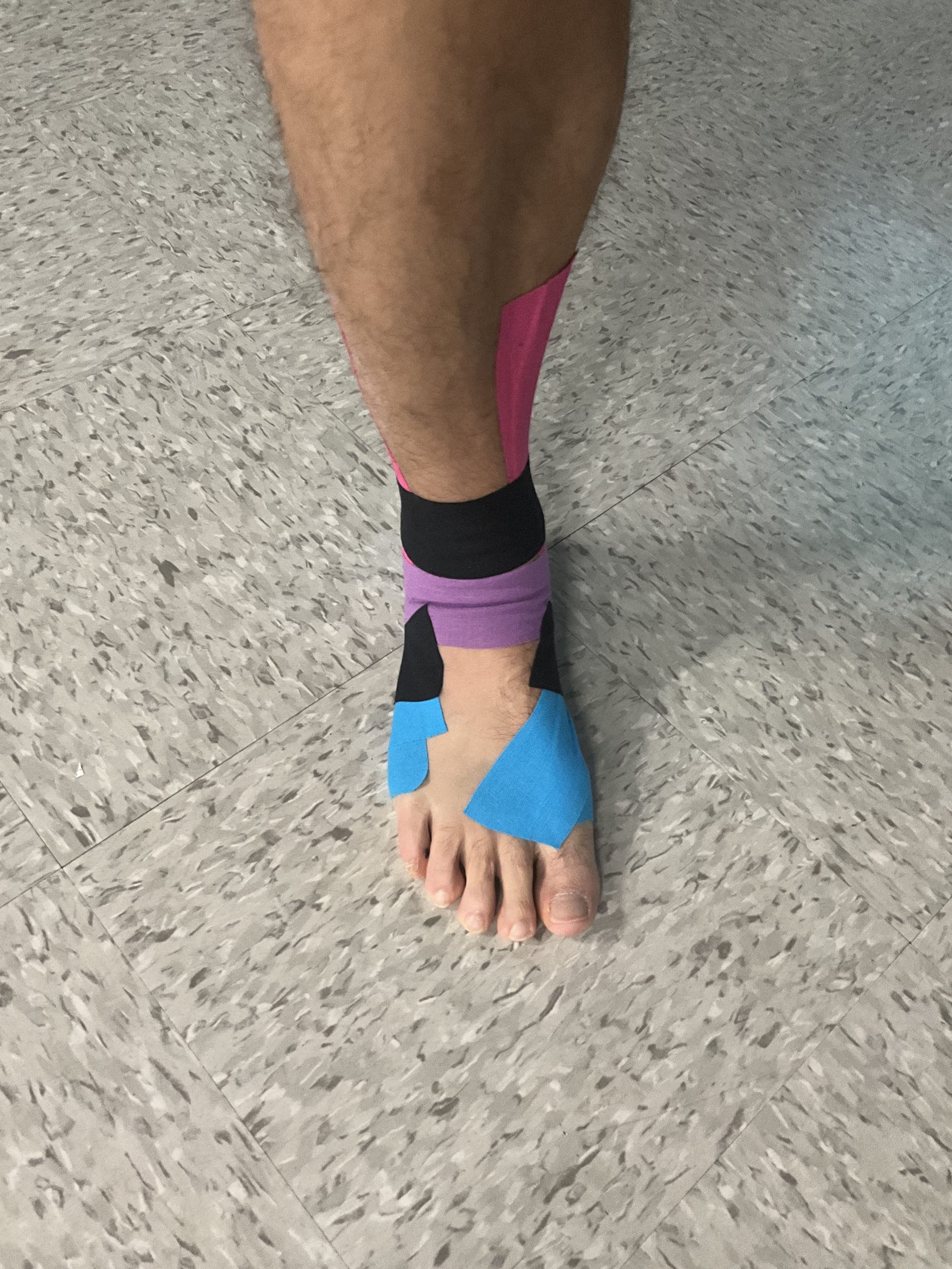 Taping neuro-proprioceptif - Saint-Georges de Beauce Jean-Alexandre Lang